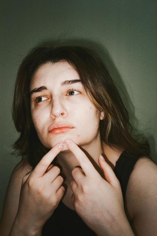All there is to know about blind pimples and how to get rid of them ...