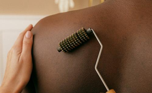 How to know you have butterfly skin disease | Bona Magazine