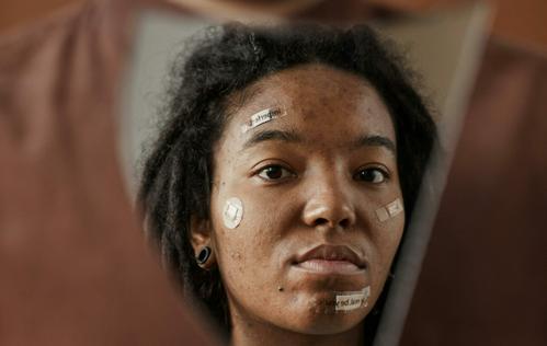 How to manage acne outbreaks through your diet | Bona Magazine