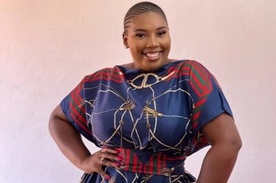 LaConco’s post surgery photos spark SA debate